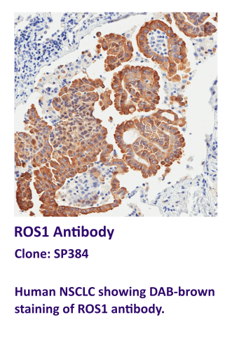 Clinical Trial IHC & Expert Pathology Review - Gnome Sciences